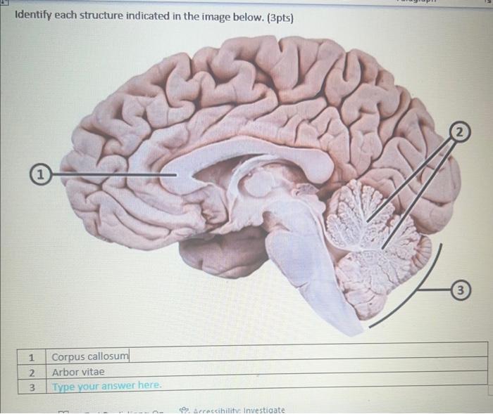 Solved Identify each structure indicated in the image below. | Chegg.com