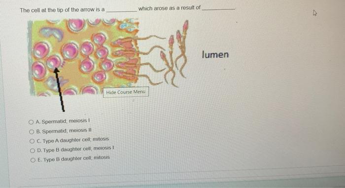 Solved The cell at the tip of the arrow is a which arose as | Chegg.com