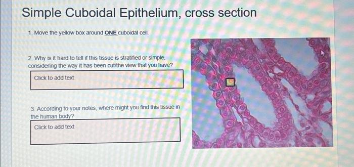 Solved Simple Cuboidal Epithelium, cross section 1. Move the | Chegg.com