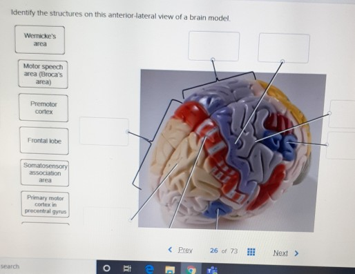 Solved Identify the structures on this anterior-lateral view | Chegg.com