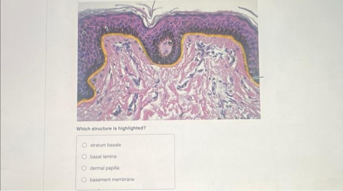 Solved Which structure is highlighted? stratum basalo basat | Chegg.com