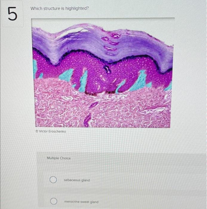 Solved Which structure is highlighted? LO 5 Victor | Chegg.com