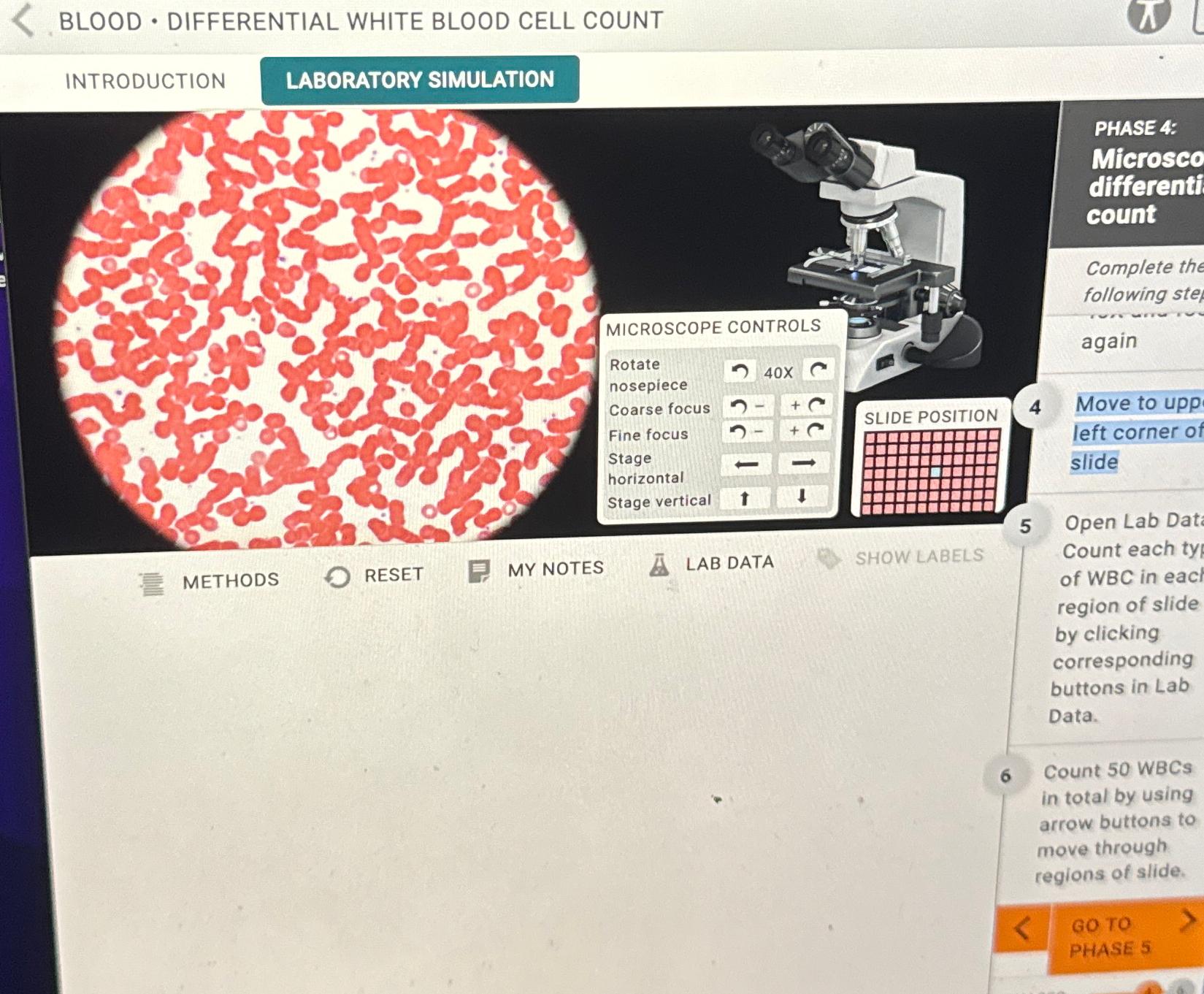 Solved BLOOD - DIFFERENTIAL WHITE BLOOD CELL | Chegg.com Solved BLOOD - DIFFERENTIAL WHITE BLOOD CELL | Chegg.com
