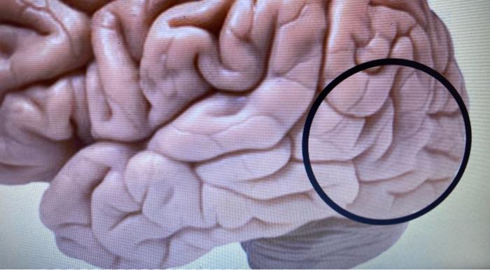 Solved Identify the depression/groove at the end of the | Chegg.com