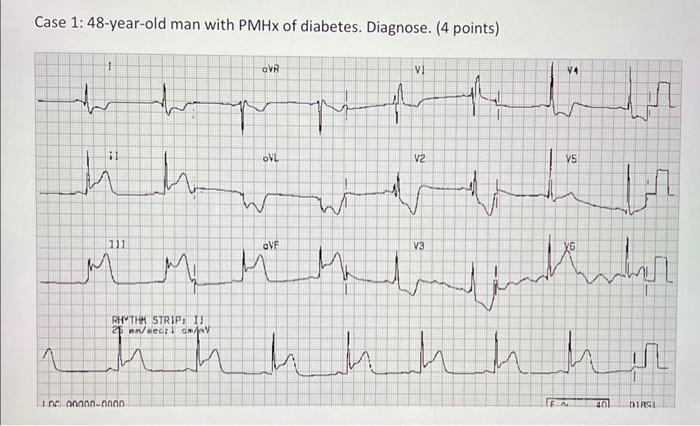 Solved Case 1: 48-year-old man with PMHx of diabetes. | Chegg.com