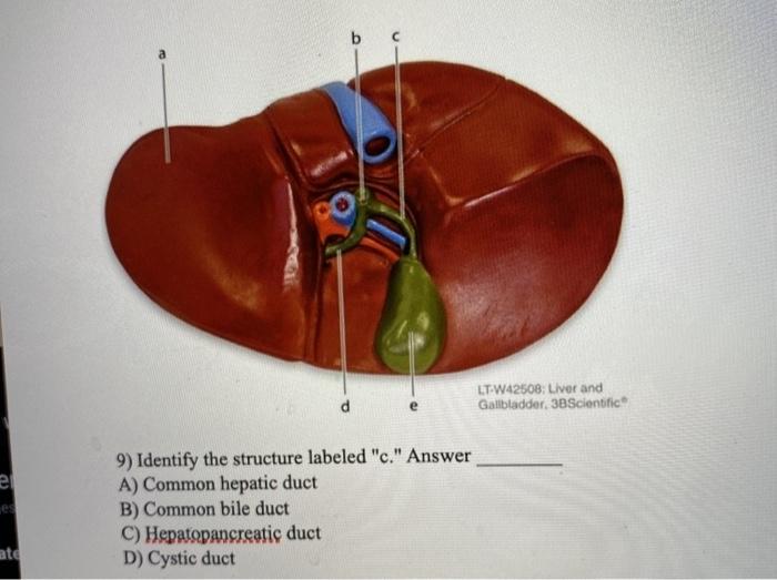 Liver Model Labeled