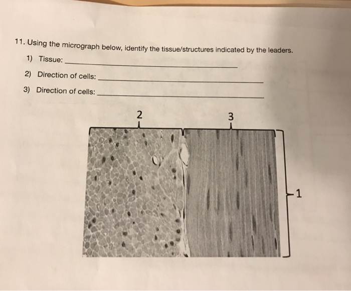 Solved 11. Using the micrograph below, identify the | Chegg.com