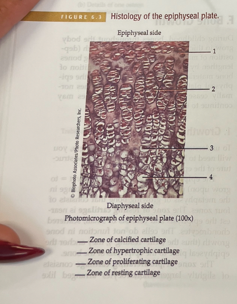 Solved FIGURE 6.3 ﻿Histology of the epiphyseal plate._ ﻿Zone | Chegg.com