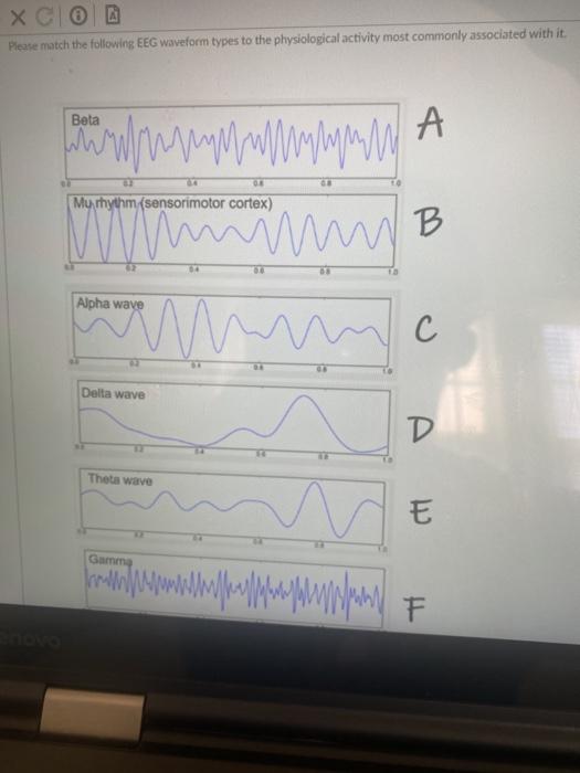Solved XCO Please match the following EEG waveform types to | Chegg.com