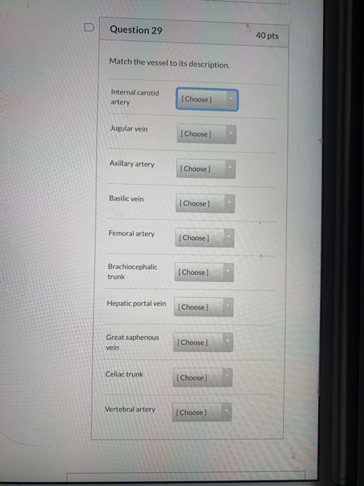 Solved Question 29 40 pts Match the vessel to its | Chegg.com