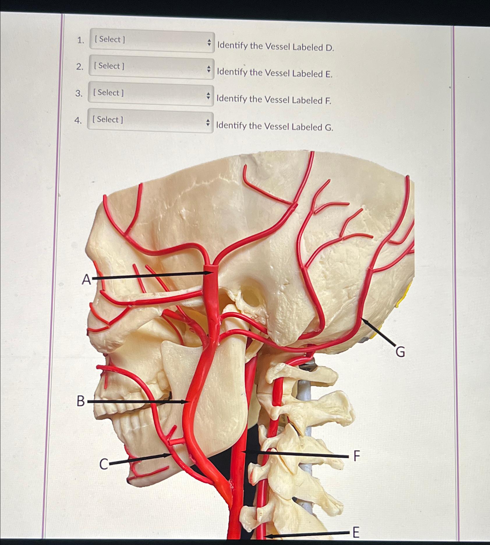 Solved Identify the Vessel Labeled D.Identify the Vessel | Chegg.com