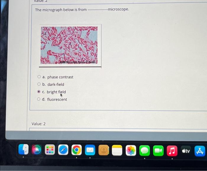 Solved The micrograph below is from -microscope. a. phase | Chegg.com
