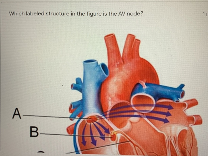 Solved Which labeled structure in the figure is the AV node? | Chegg.com