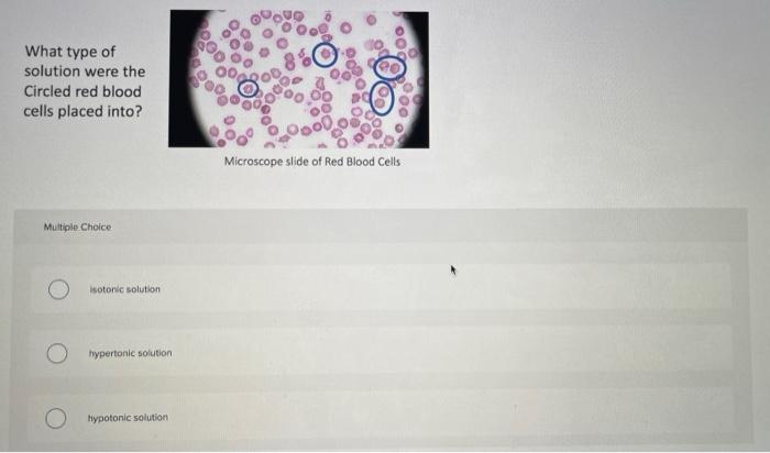 Solved What type of solution were the Circled red blood | Chegg.com