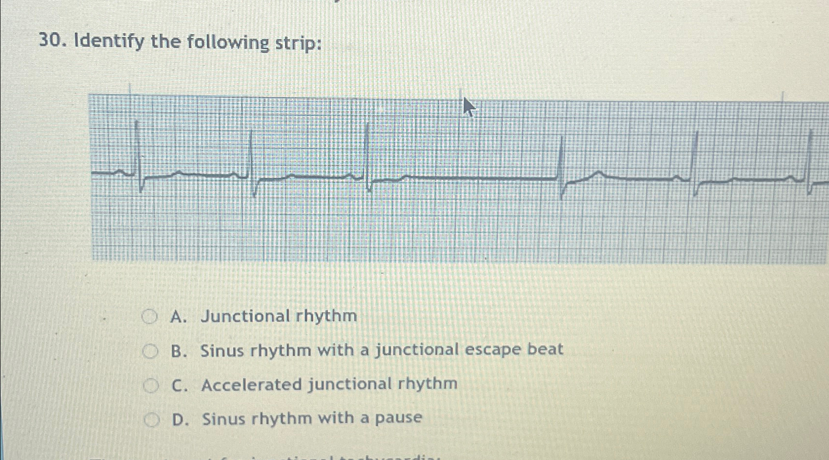Solved Identify the following strip: ﻿A. ﻿Junctional | Chegg.com