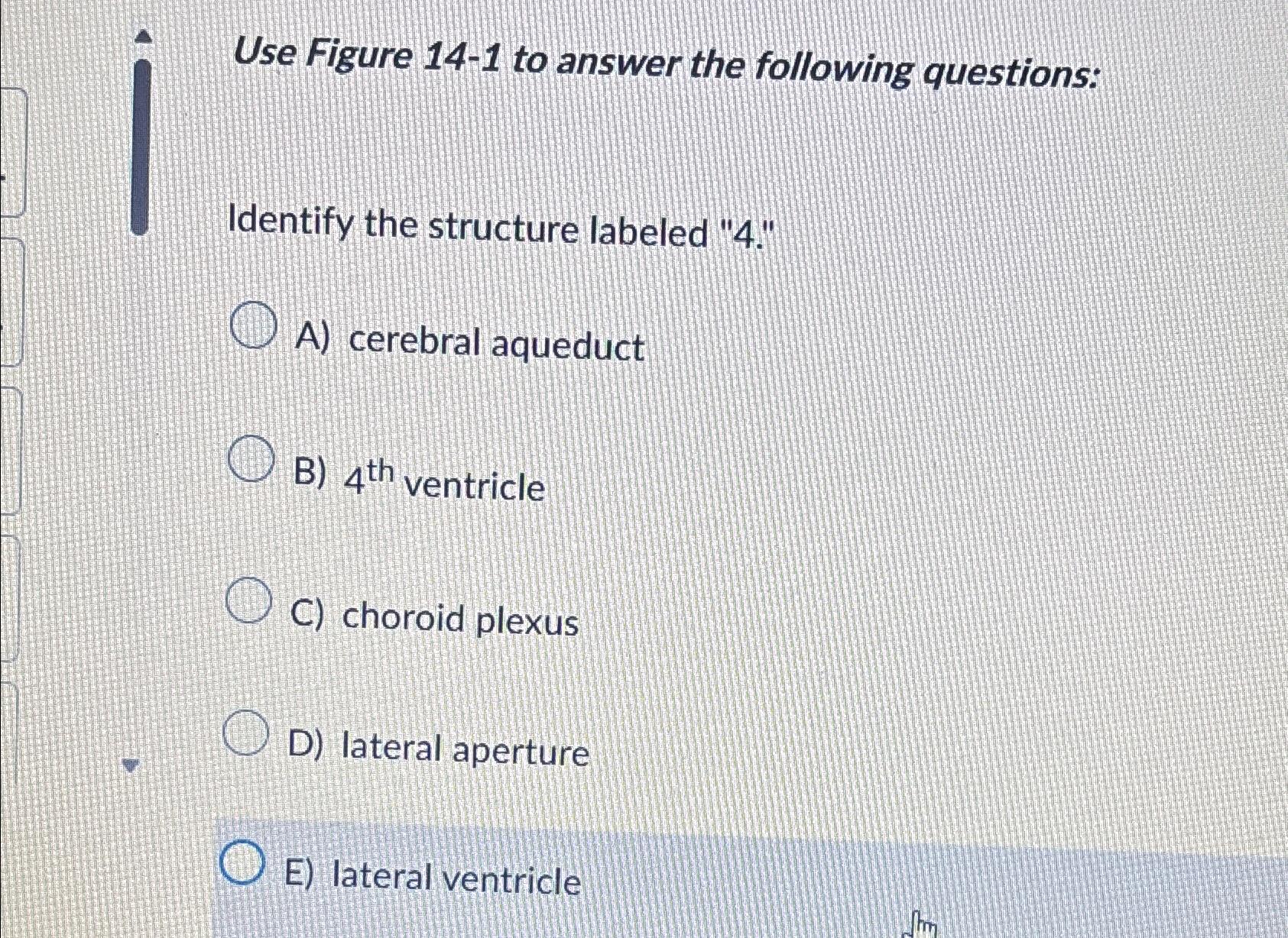 Solved Use Figure 14-1 ﻿to answer the following | Chegg.com