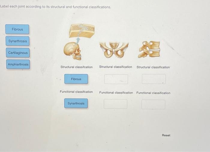Solved Label each joint according to its structural and | Chegg.com