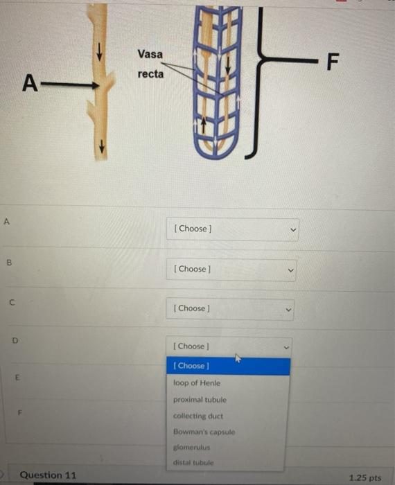 Solved Identify and label the nephron structures and | Chegg.com