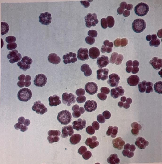 Solved Find the following stages of development on the | Chegg.com