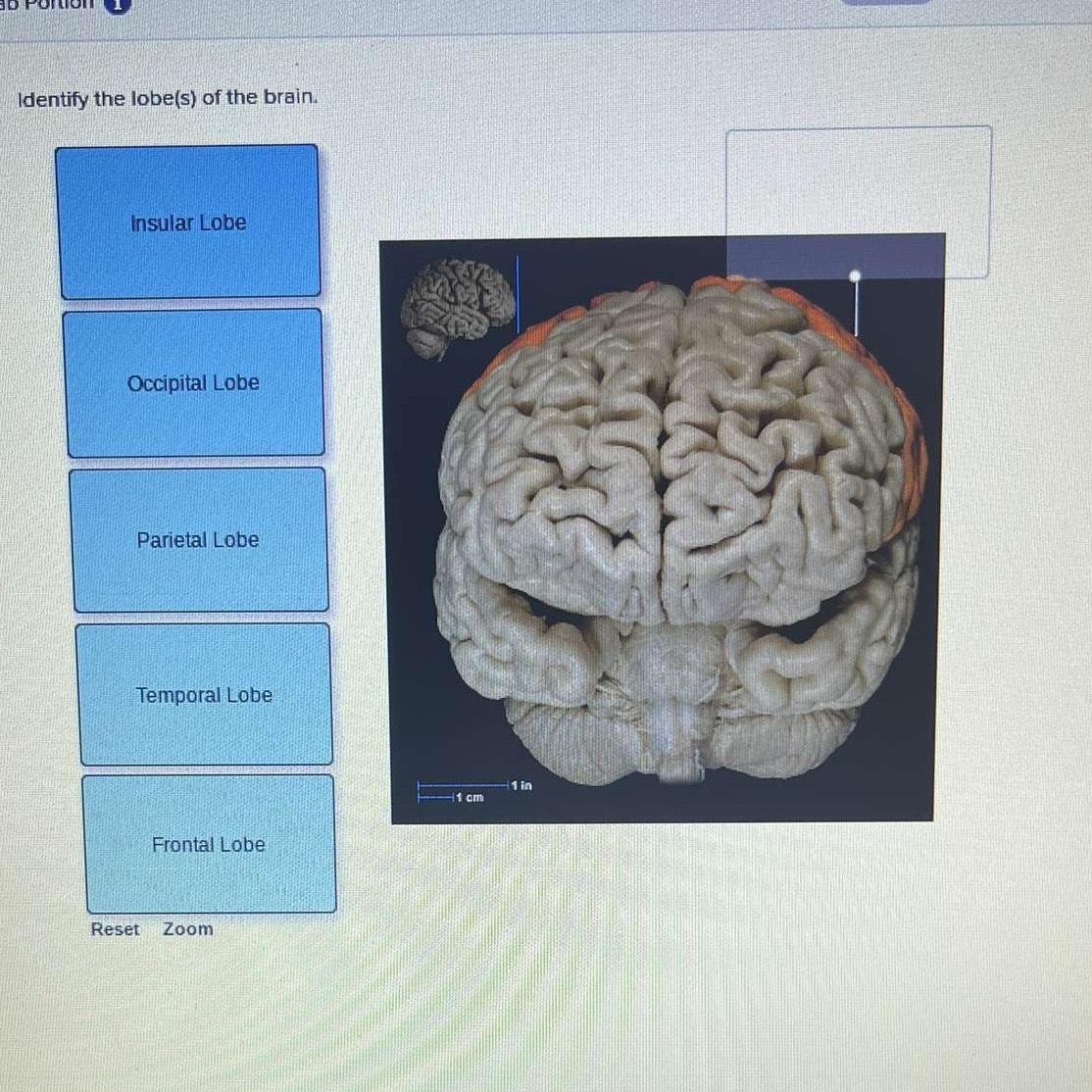 Identify the lobe(s) ﻿of the brain.Occipital | Chegg.com