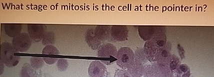 Solved What stage of mitosis is the cell at the pointer in? | Chegg.com