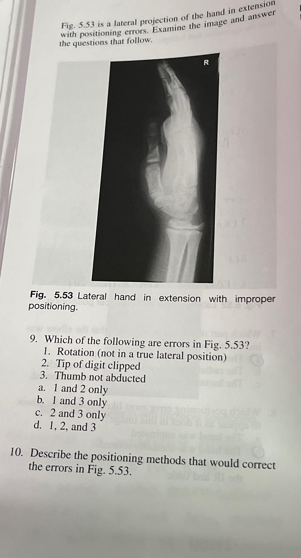 Solved Fig. 5.53 ﻿is a lateral projection of the hand in | Chegg.com