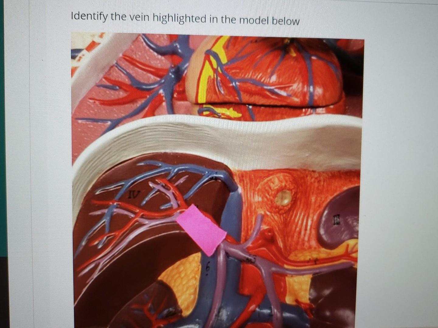 Solved Identify the vein highlighted in the model below IV | Chegg.com