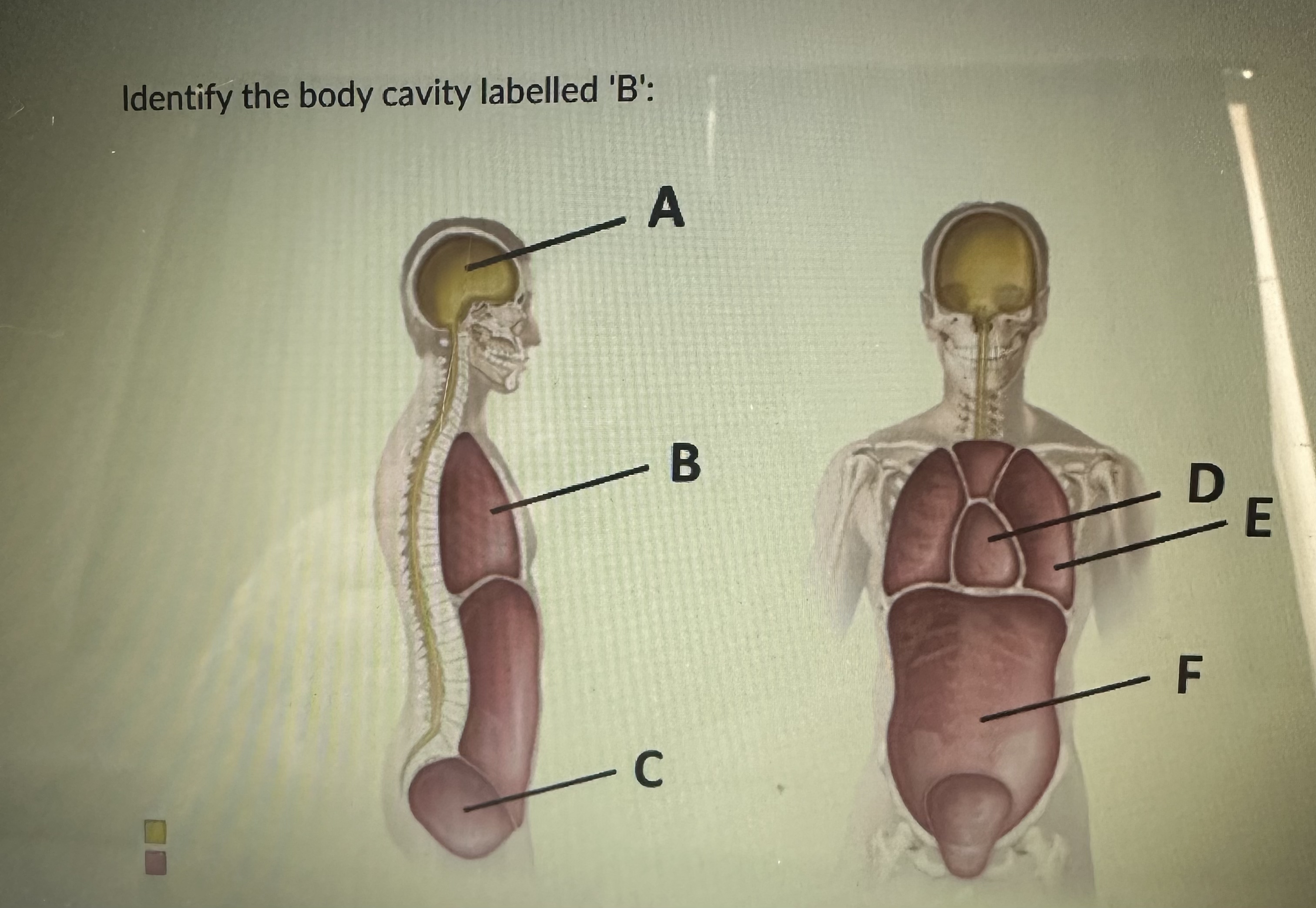 Solved Identify the body cavity labelled 'B': | Chegg.com
