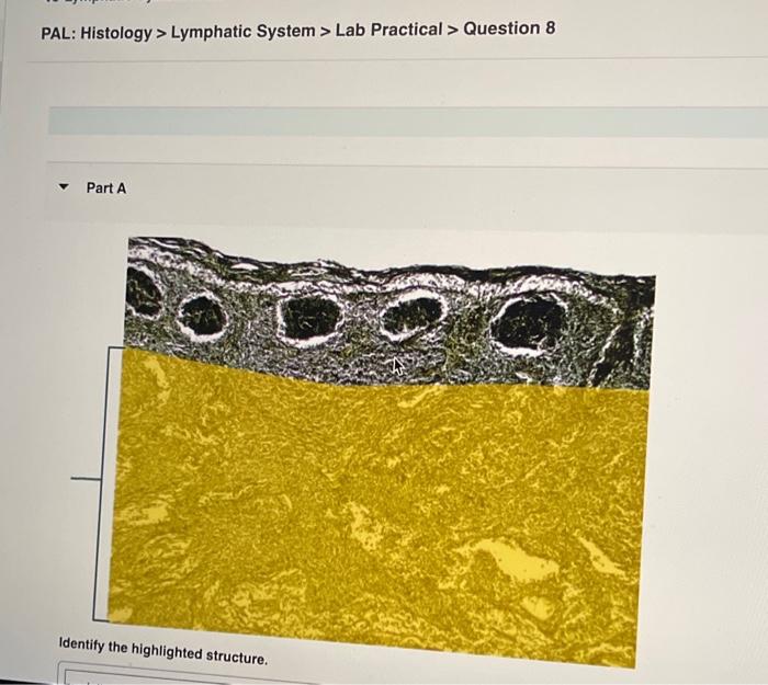 Solved Id PAL: Histology > Lymphatic System > Lab Practical | Chegg.com