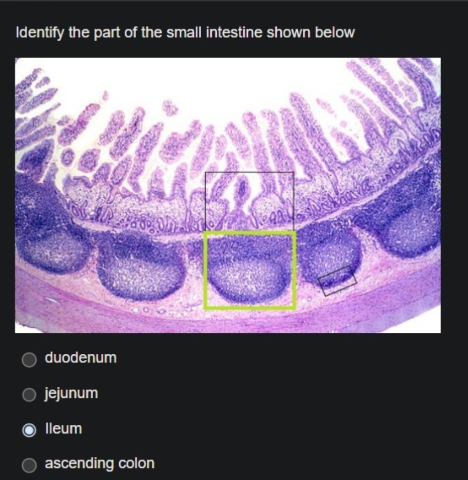 Solved Identify the part of the small intestine shown | Chegg.com