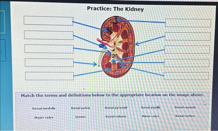 Solved Match the terms and definitions below to the | Chegg.com