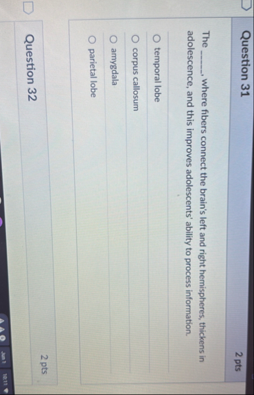 Solved Question 312 ﻿ptsThe ﻿where fibers connect the | Chegg.com