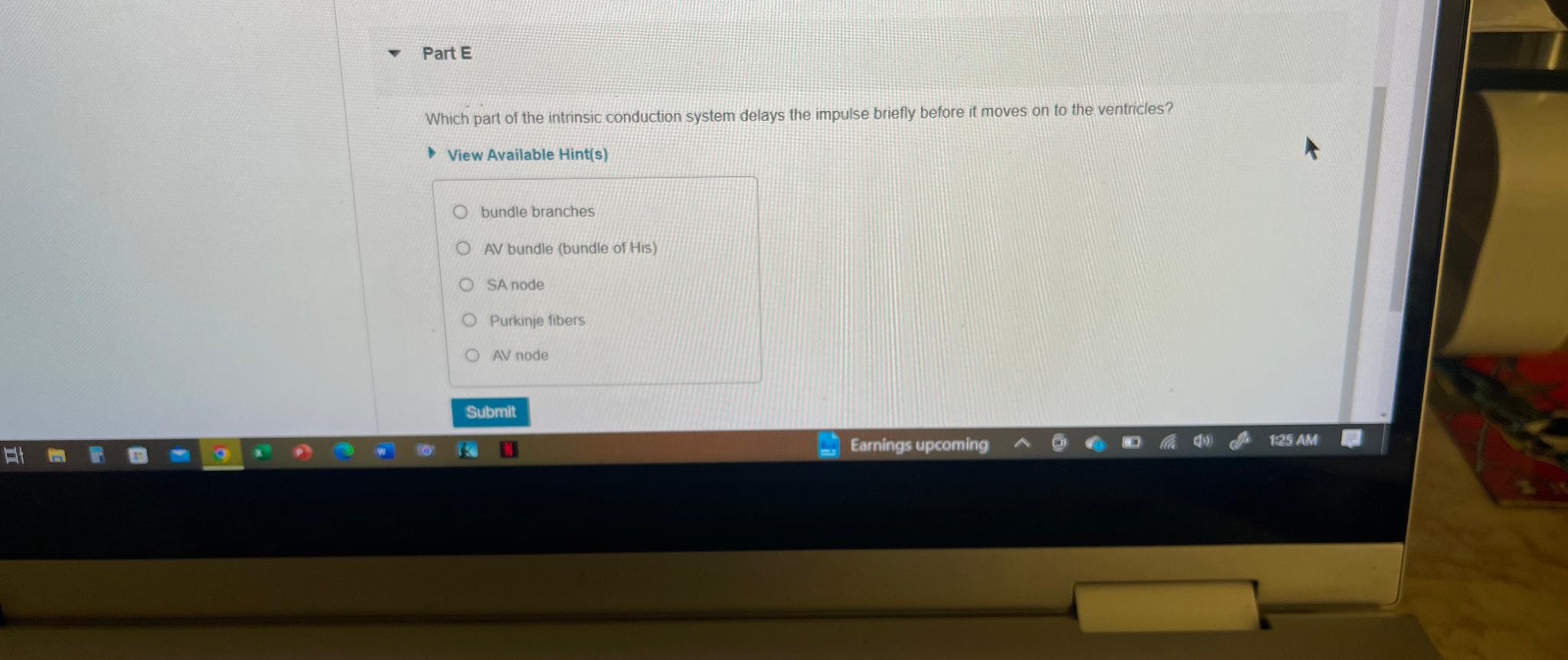 Solved Part EWhich part of the intrinsic conduction system | Chegg.com