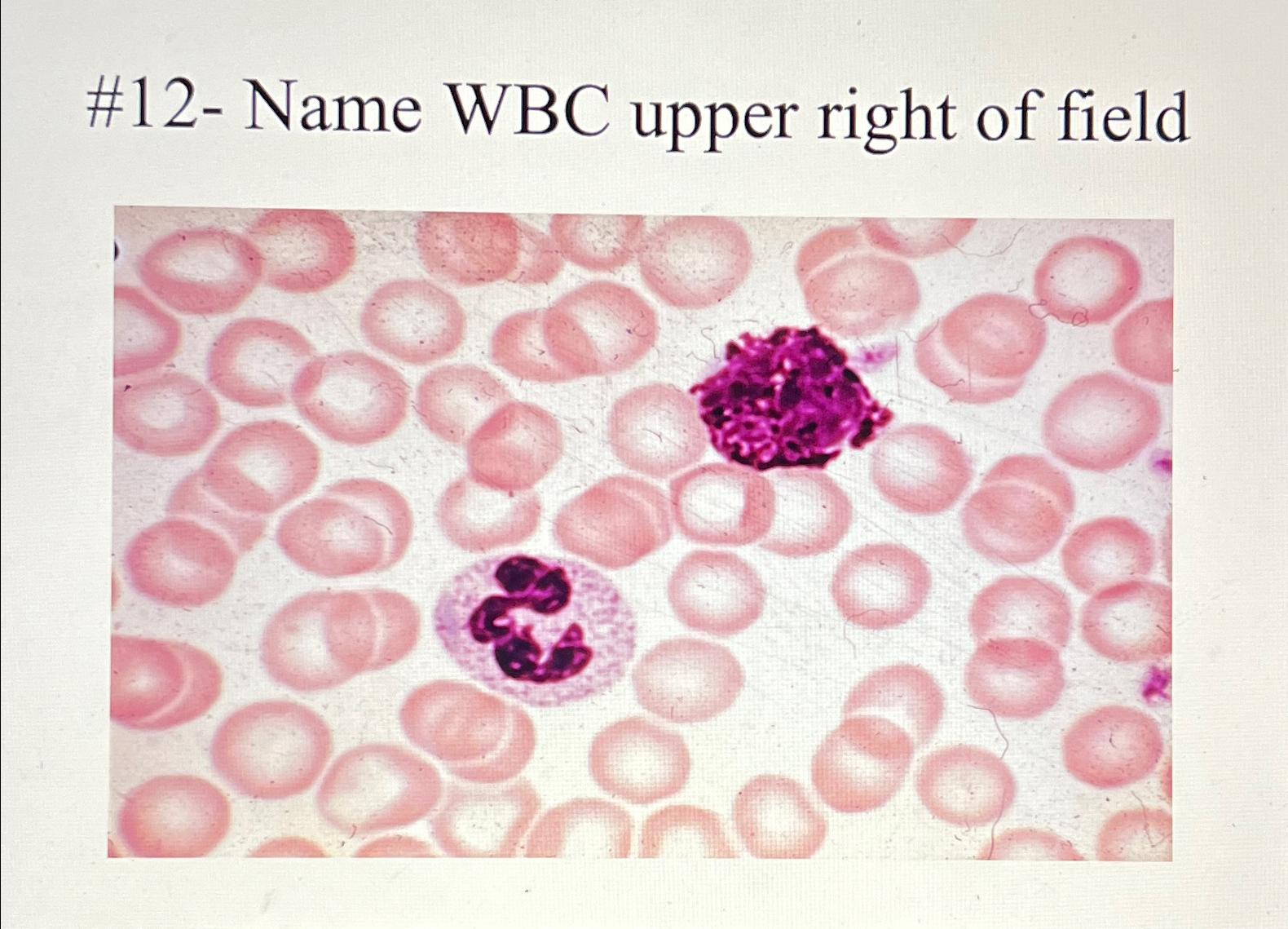 Solved #12- ﻿Name WBC upper right of field | Chegg.com