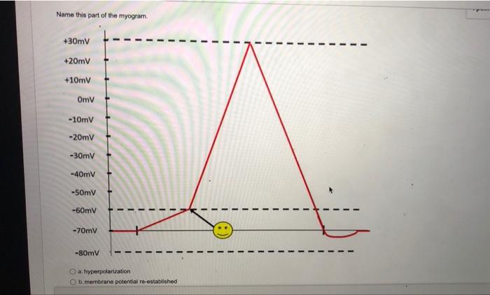 Solved Name this part of the myogram. +30mV +20mV +10mV OmV | Chegg.com