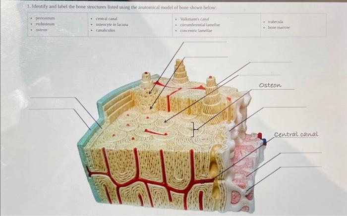 Solved 1. Identify and label the bone structures listed | Chegg.com