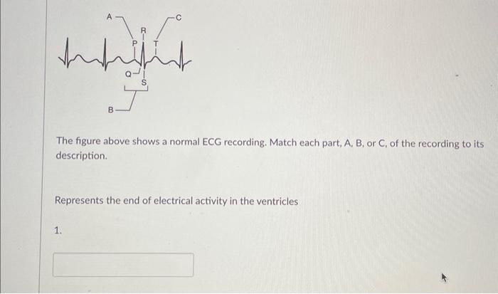 Solved The figure above shows a normal ECG recording. Match | Chegg.com