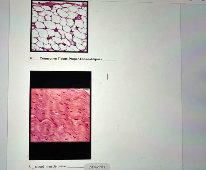Solved 5. Transitional Epithelium8. cartilage 9. Connective | Chegg.com