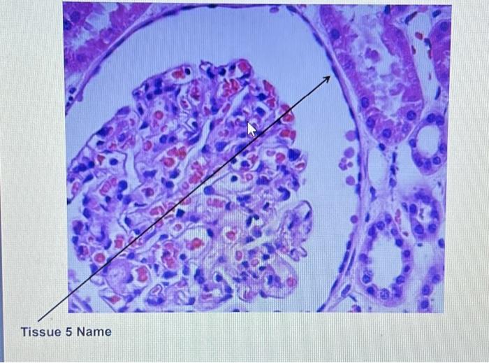 Solved Tissue 5 Name Tissue 4 Name | Chegg.com