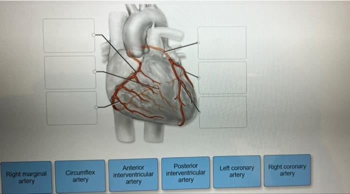 Solved Right marginal artery Circumflex artery Anterior | Chegg.com