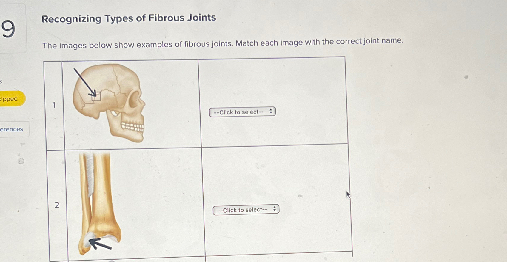 Solved Recognizing Types of Fibrous JointsThe images below | Chegg.com Solved Recognizing Types of Fibrous JointsThe images below | Chegg.com