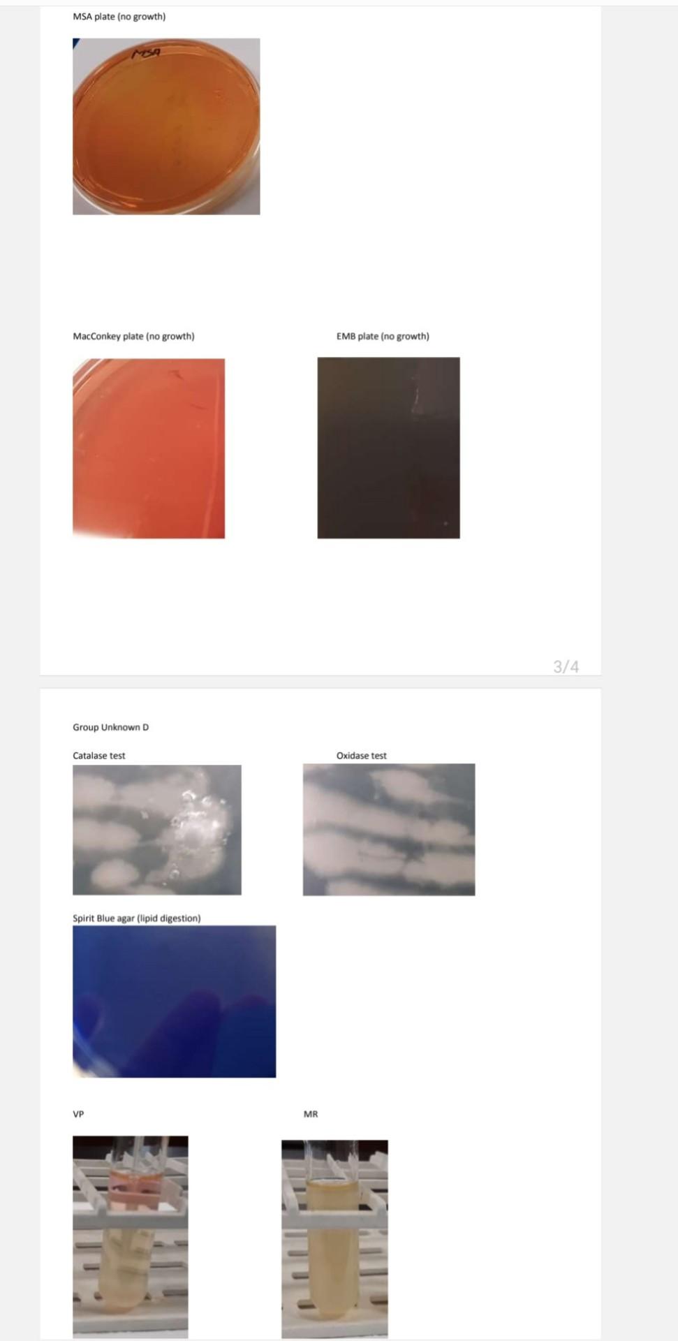 Gram stain Spore stain SIM test Simmons citrate urea | Chegg.com