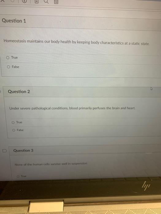 Solved Homeostasis maintains our body health by keeping body | Chegg.com
