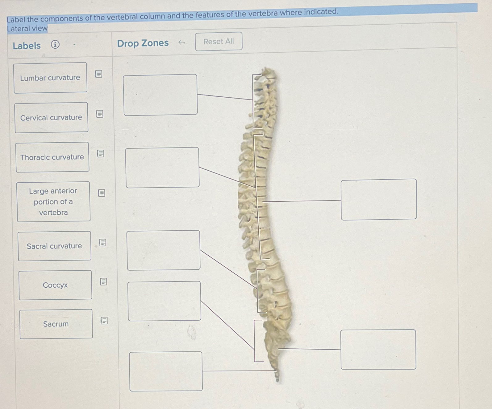 Solved Label the components of the vertebral column and the | Chegg.com