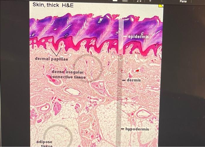 Solved question 1 - based off the think and thick skin | Chegg.com