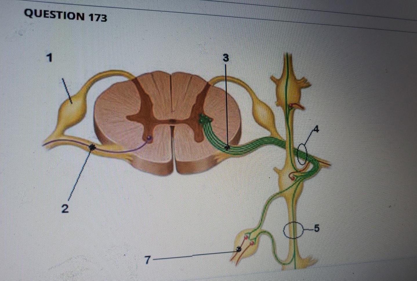 Solved QUESTION 173 1 2 -5 eo 7 6 This figure shows the | Chegg.com