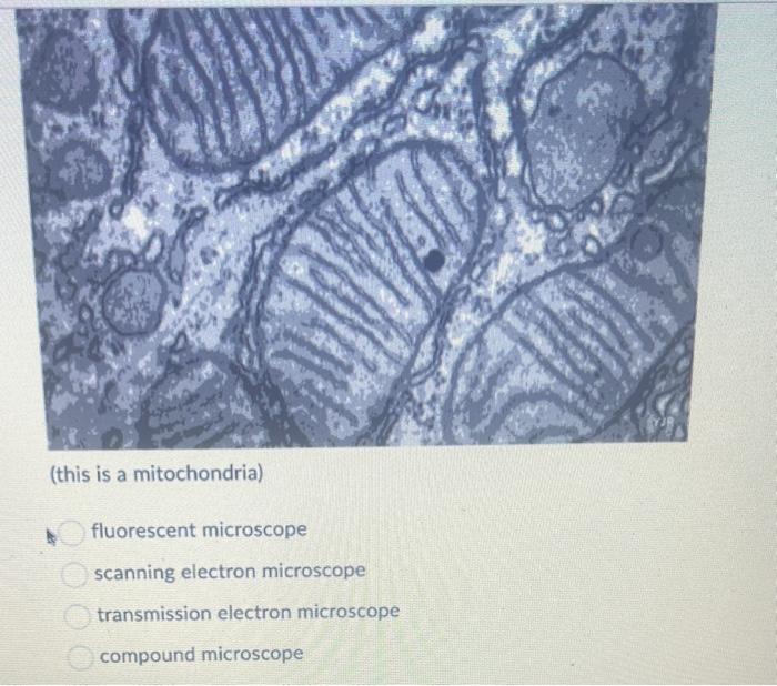 Solved (tnis is a mitocrionaria) fluorescent | Chegg.com