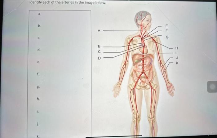 Solved Identify each of the arteries in the image below. | Chegg.com