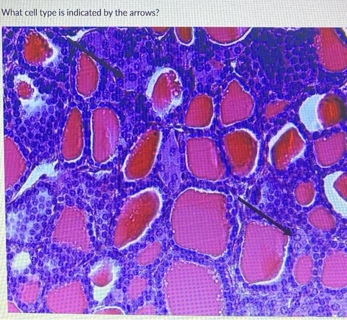 Solved What cell type is indicated by the arrows? | Chegg.com