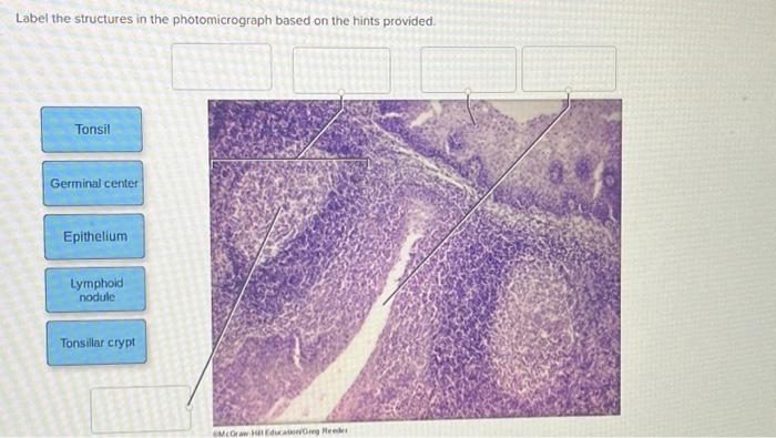 [Solved]: Label the structures in the photomicrograph based